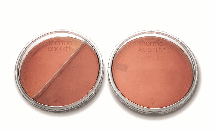 Automation-compatible prepared culture media plate technology boosts ...